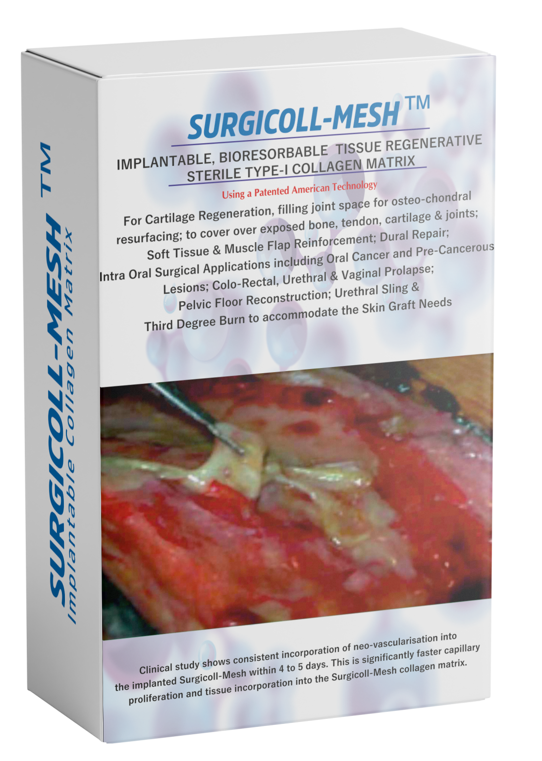 Encoll’s Type-I collagen is applicable for varied surgical biomedical ...